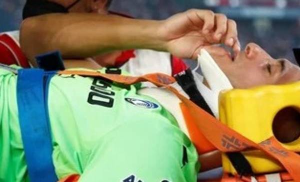 Un fuerte golpe le provocó la fractura del pómulo derecho a Juan Musso ...