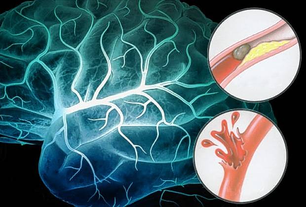 Es importante aprender más sobre el ACV
